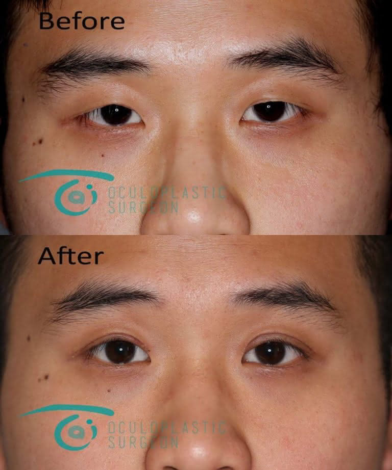Dr Tai Smith | Eye Gallery | Dr Tai Smith