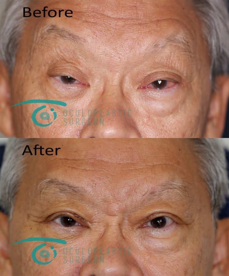 Dr Tai Smith | Eye Gallery | Dr Tai Smith