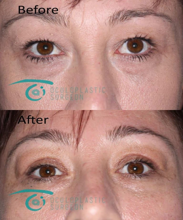 Dr Tai Smith | Eye Gallery | Dr Tai Smith