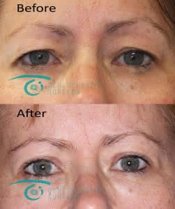 Dr Tai Smith | Eye Gallery | Dr Tai Smith