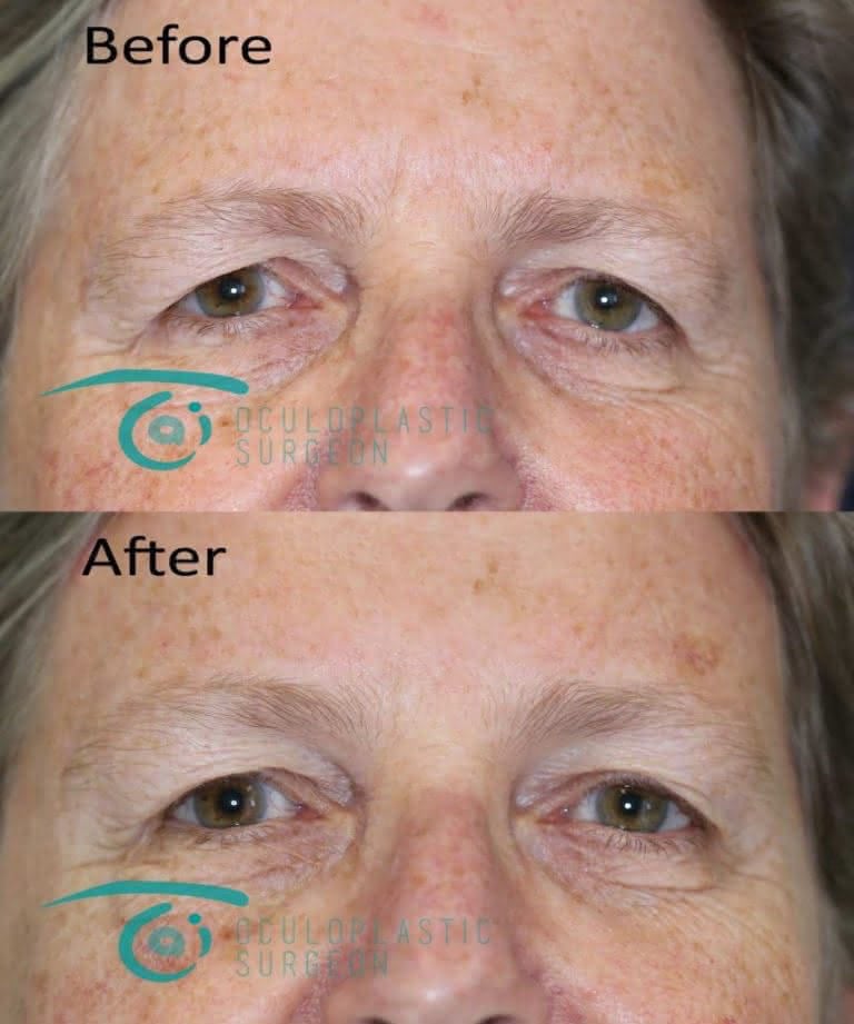 Dr Tai Smith | Eye Gallery | Dr Tai Smith