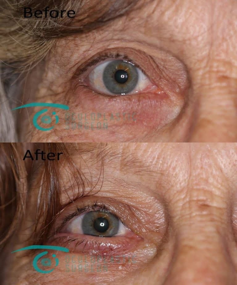 Dr Tai Smith | Eye Gallery | Dr Tai Smith