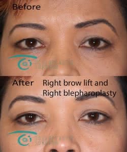 Dr Tai Smith | Eye Gallery | Dr Tai Smith